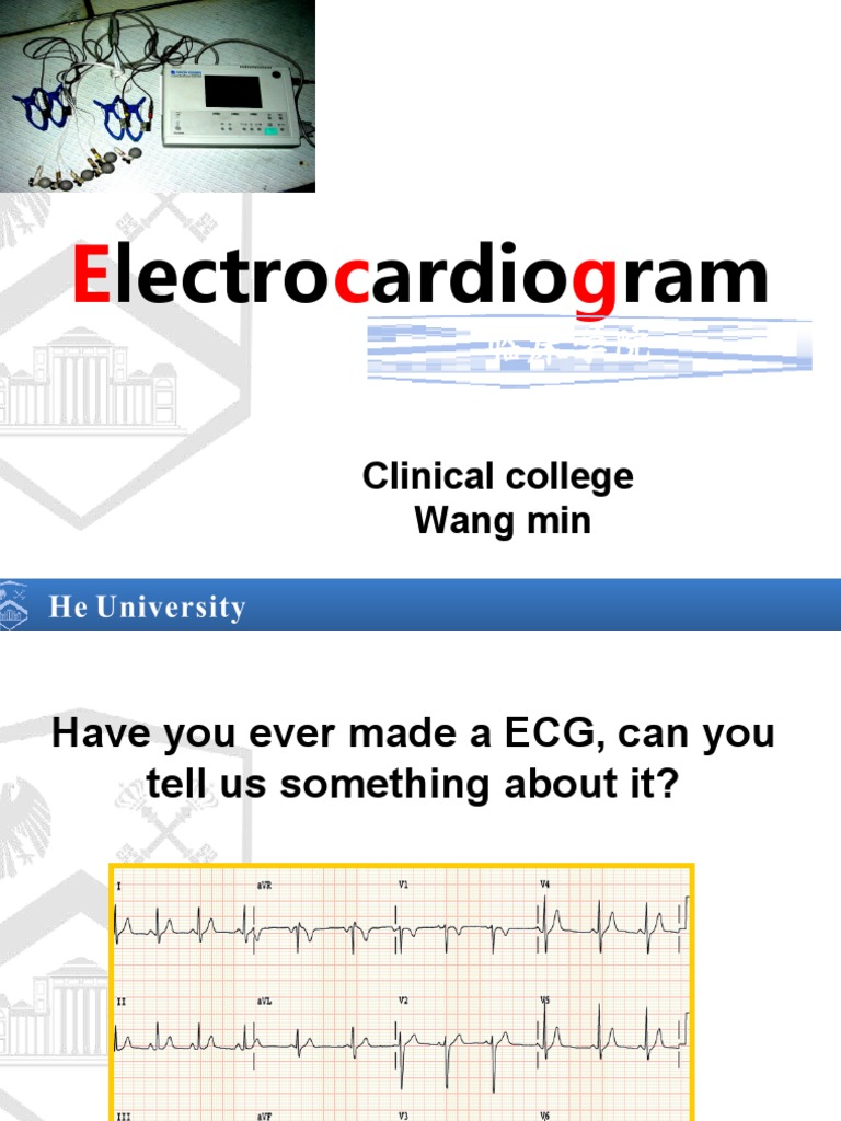Basic Concepts of Clinical ECG | PDF | Electrocardiography | Medical ...