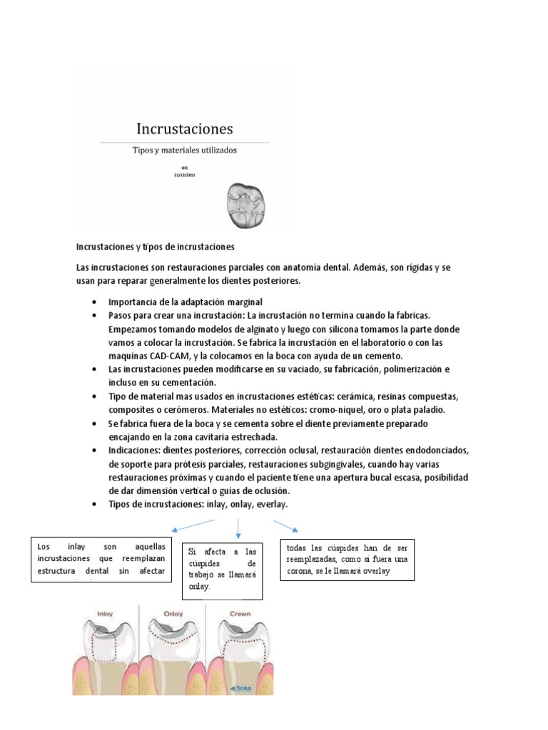 Incrustaciones y Tipos de Incrustaciones | PDF