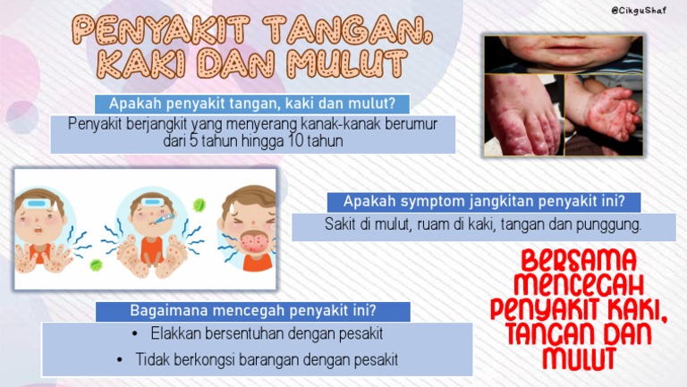 CTH Poster Penyakit Tangan, Kaki Dan Mulut T2 | PDF