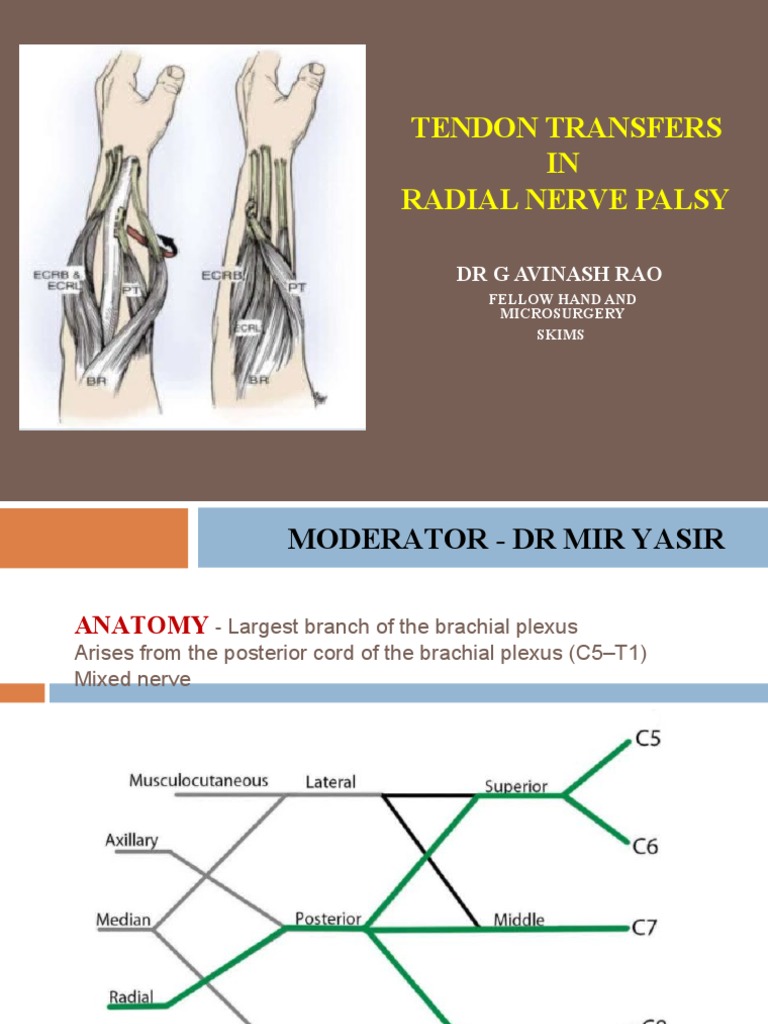 Tendon Transfers For Radial Nerve Palsy | PDF | Human Anatomy ...