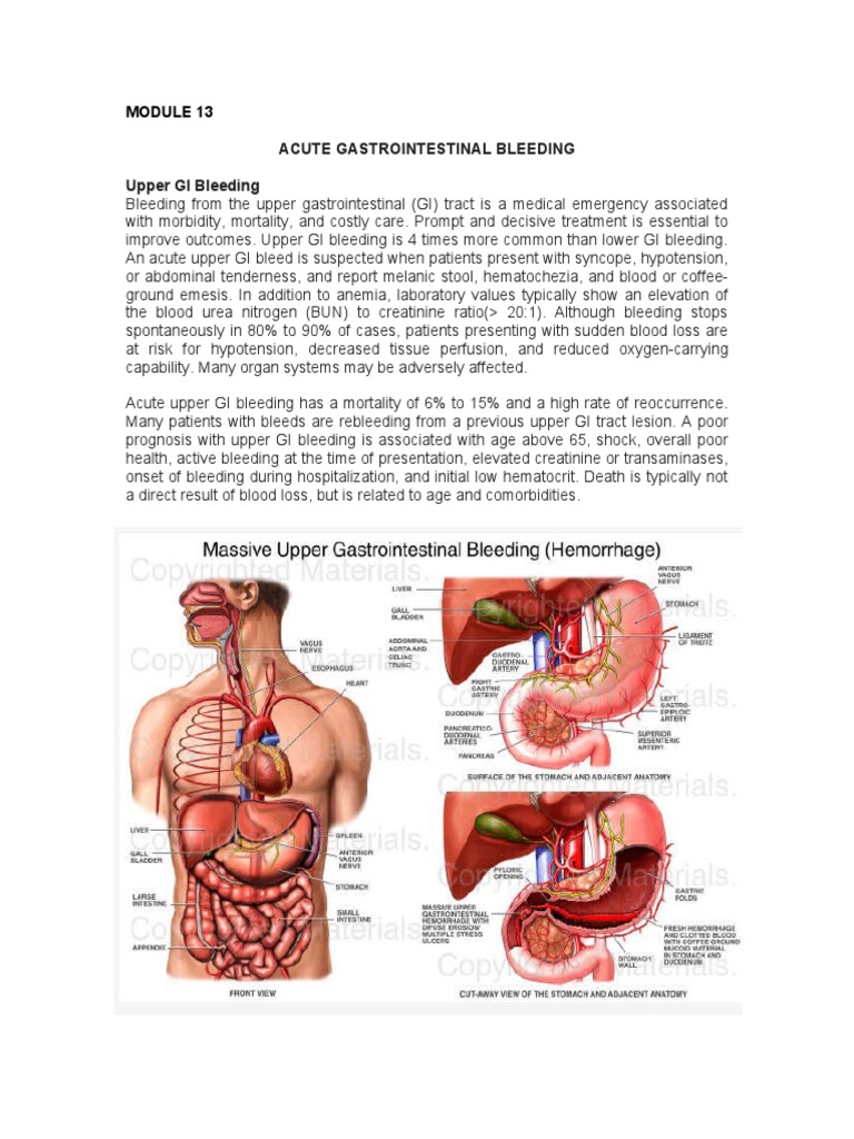 Acute Gastrointestinal Bleeding Upper GI Bleeding | PDF | Esophagus ...