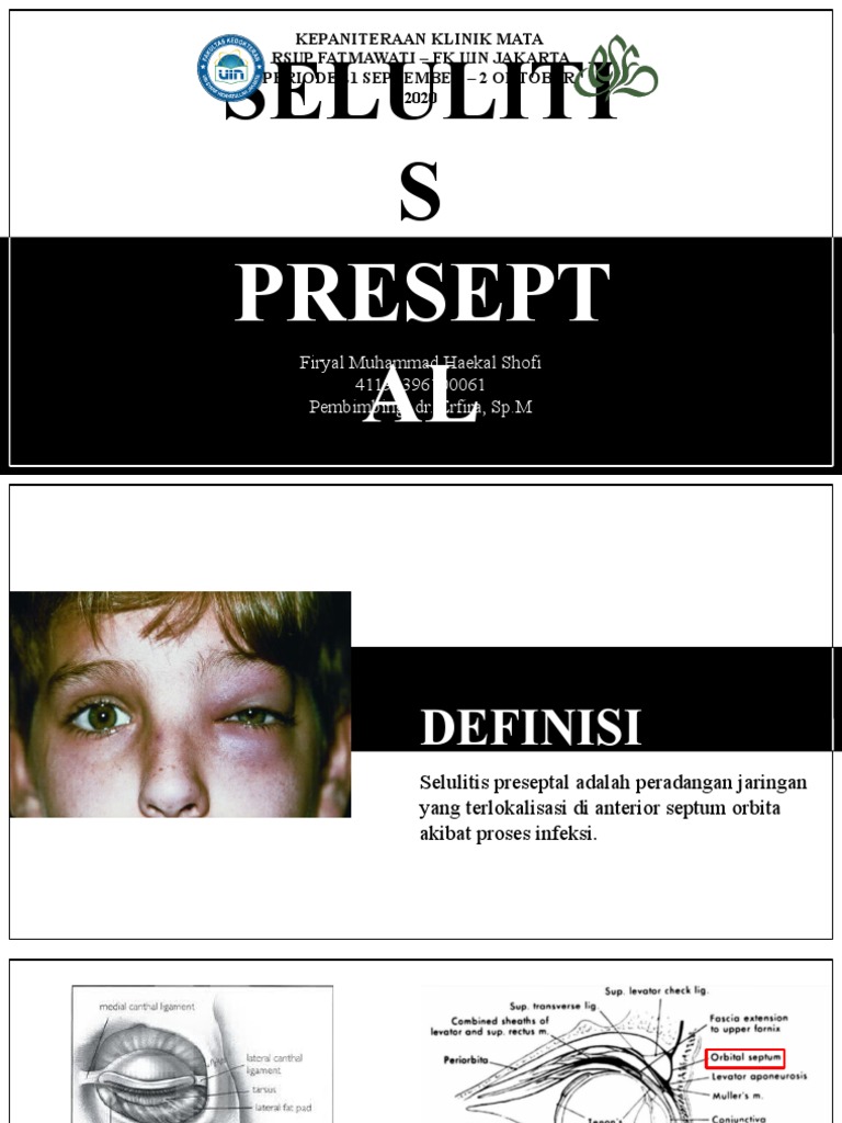 Selulitis Preseptal: Diagnosis dan Terapi | PDF