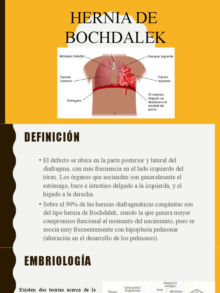 Hernia Bochdalek | PDF | Pulmón | Especialidades Medicas