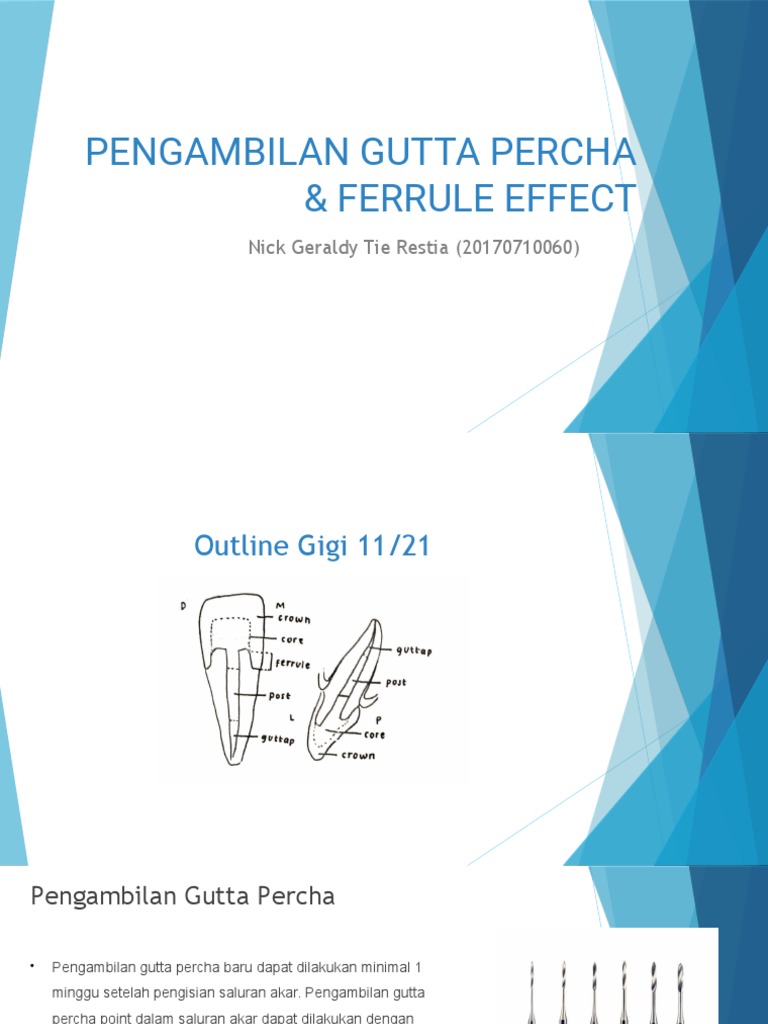 Ferrule Effect - B2 - Nick Geraldy - 20170710060 | PDF