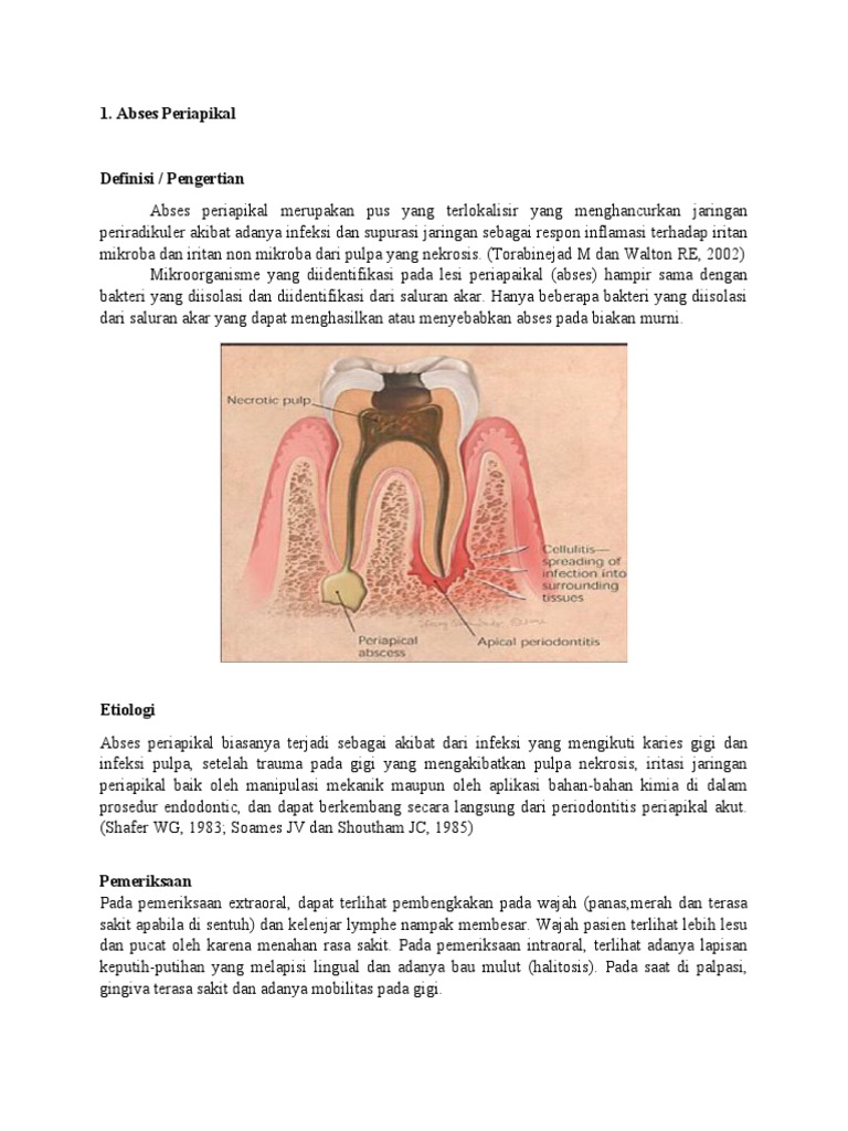 Abses Periapikal | PDF