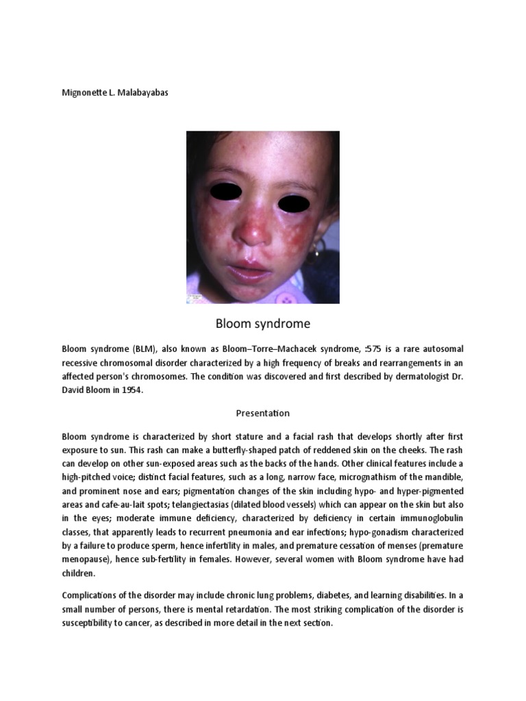 Bloom Syndrome | PDF