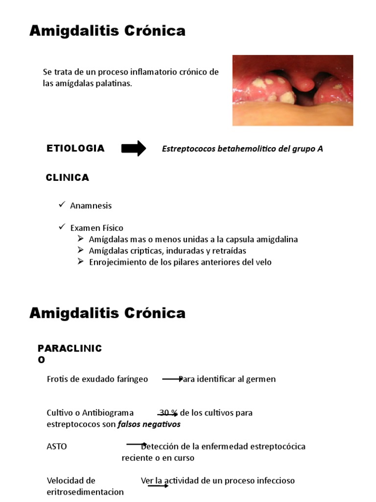 Diapositivas Amigdalitis | PDF