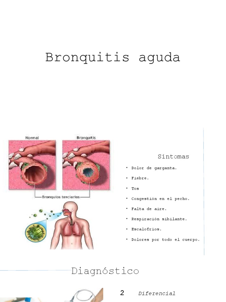 Bronquitis Aguda | PDF