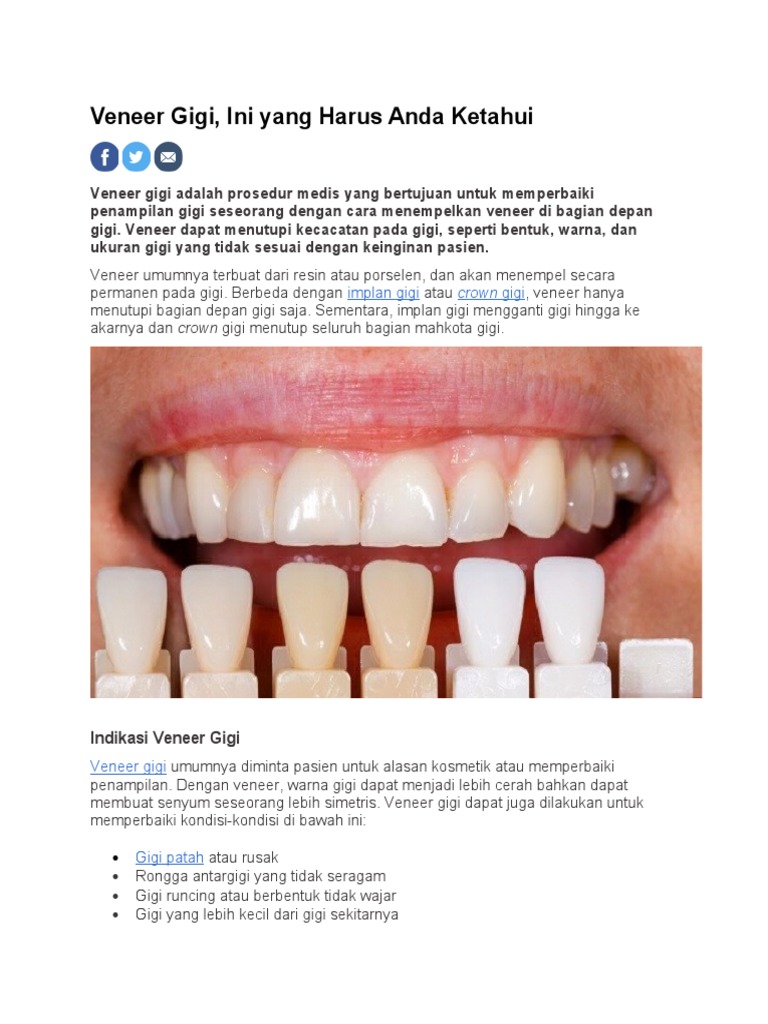 Panduan Lengkap Veneer Gigi | PDF