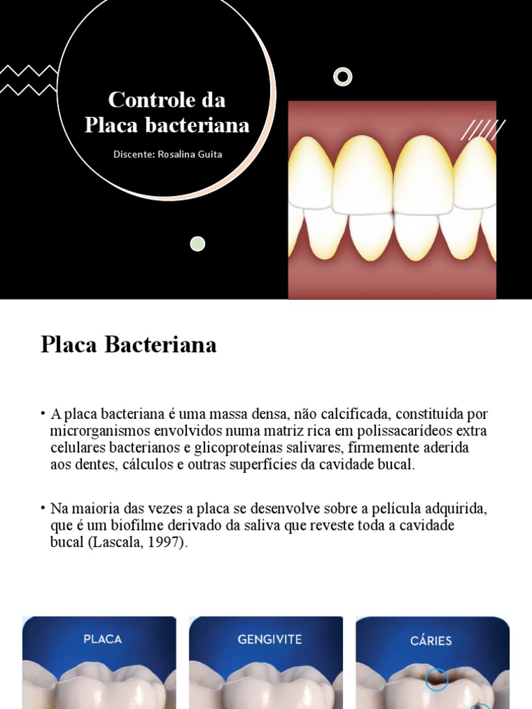 Placa Bacteriana 1 | PDF | Odontologia | Boca
