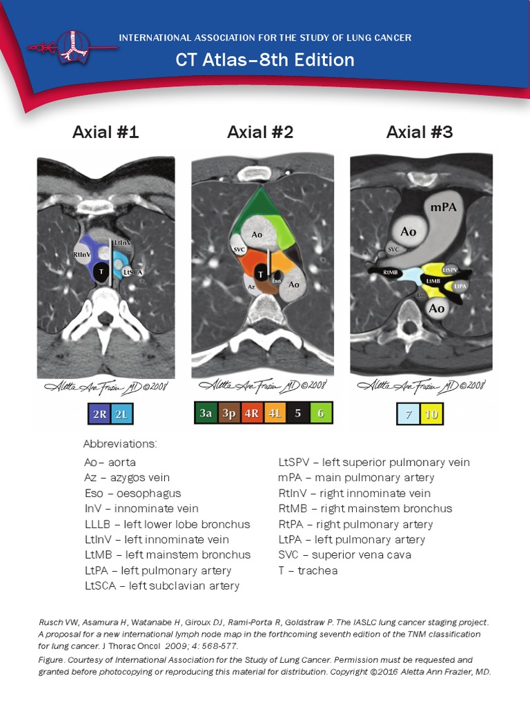 Plaman Pleura Esofag Timus Stadializari | PDF | Aorta | Metastasis