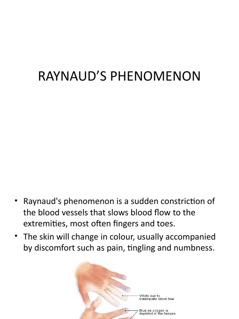 Raynaud's Phenomenon | PDF | Medical Specialties | Clinical Medicine
