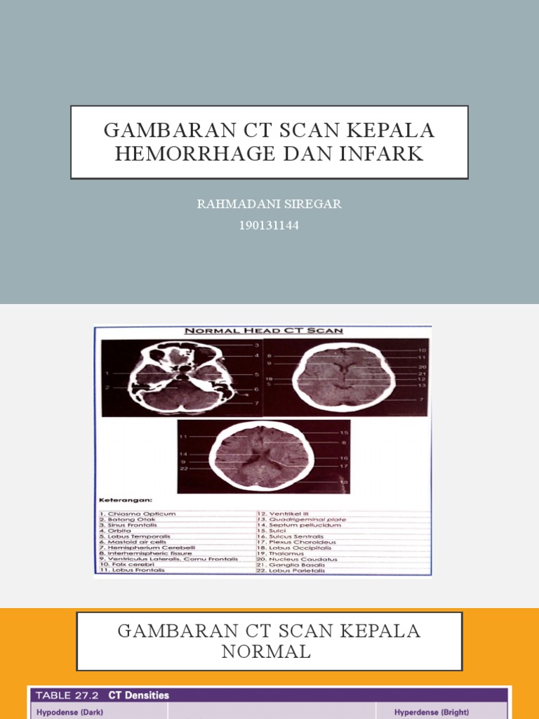 Head CT Scan Perdarahan | PDF