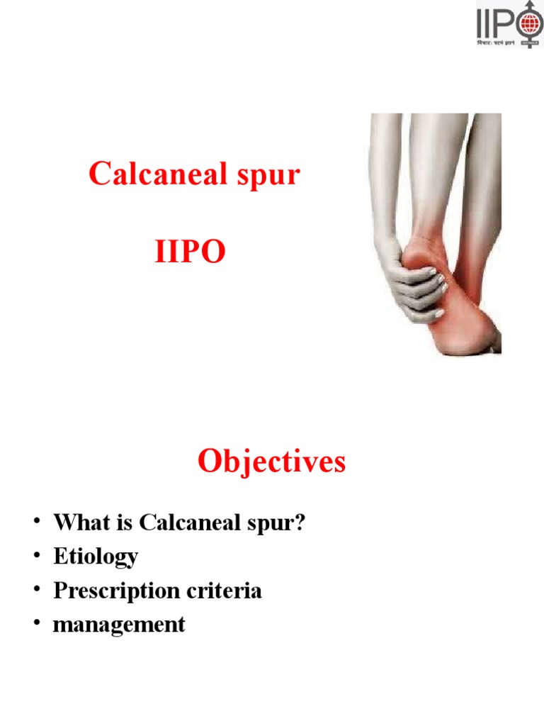 Calcaneal Spur | PDF | Musculoskeletal Disorders | Musculoskeletal System