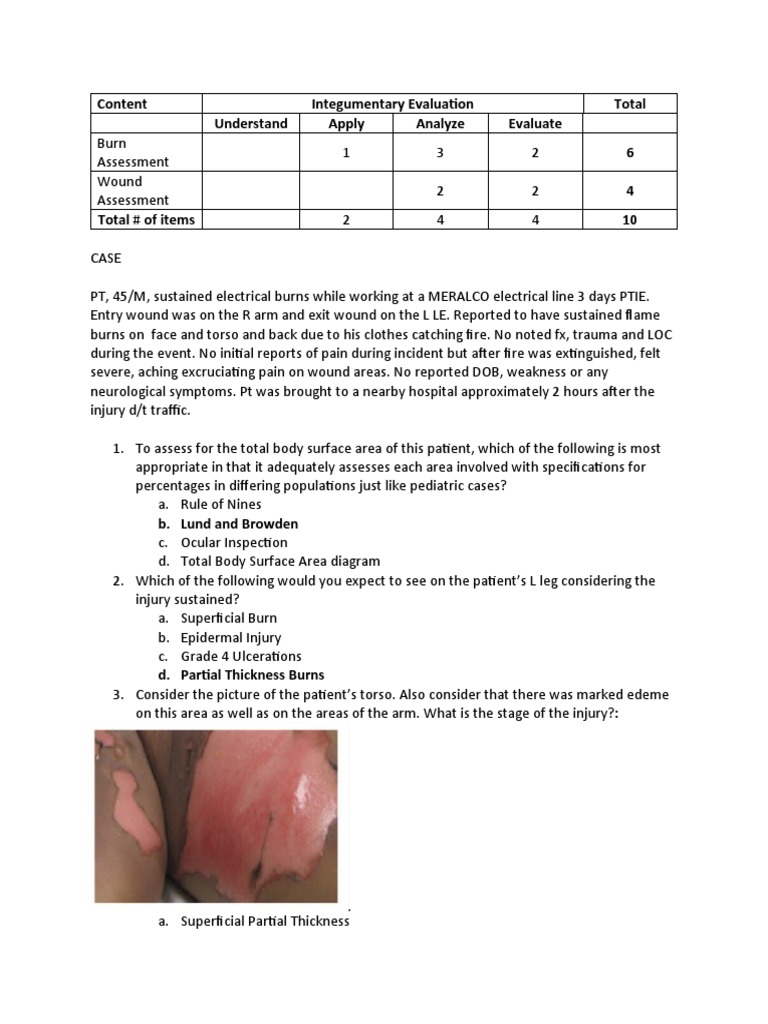 05132021.integumentary Exam Blueprint | PDF | Scar | Burn