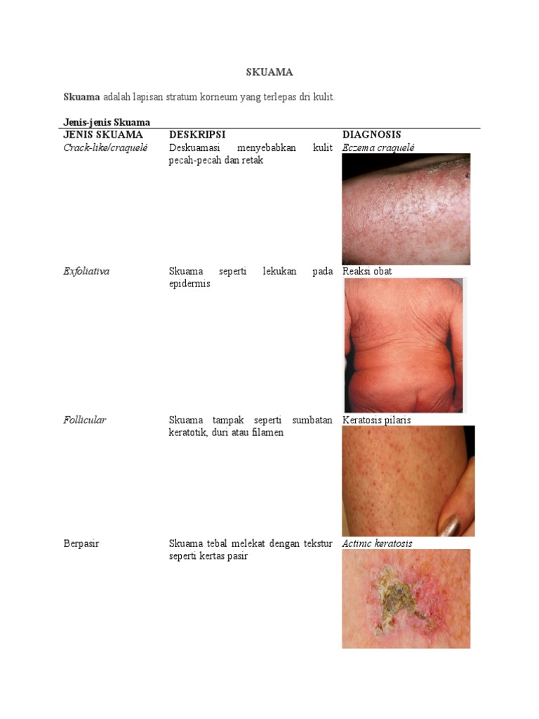 Jenis Squama | PDF