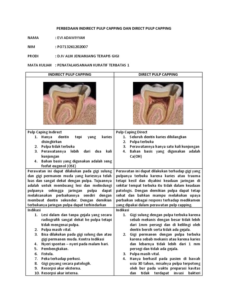 Perbedaan Indirect Pulp Capping Dan Direct Pulp Capping | PDF