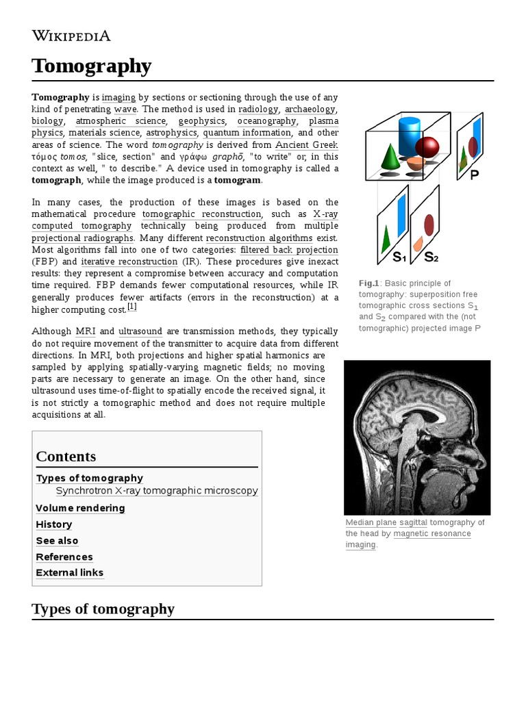 Tomography: Tomography Is Imaging by Sections or Sectioning Through The ...