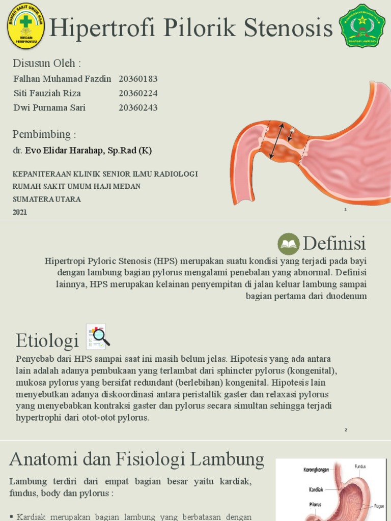 Hipertrofi Stenosis Pilorus pada Bayi | PDF