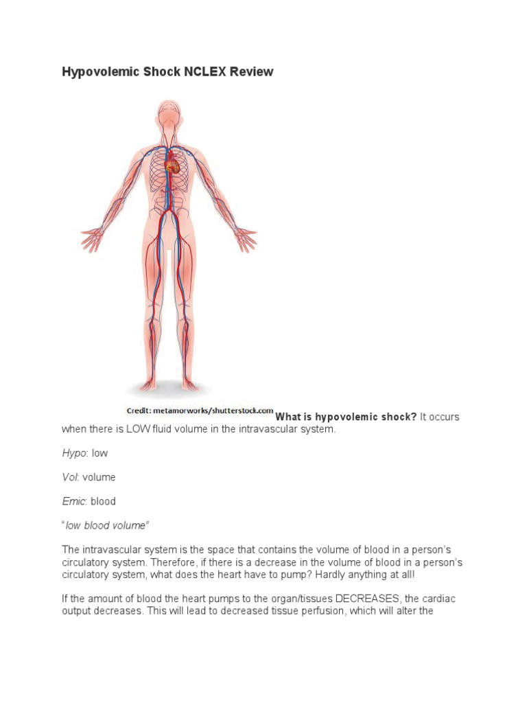 Hypovolemic Shock NCLEX Review: Hypo: Low Vol: Volume Emic: Blood | PDF ...