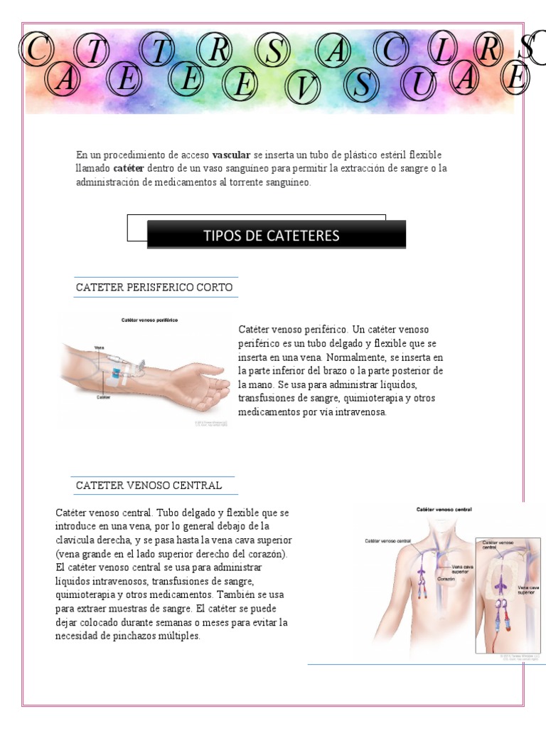 Tipos de Cateteres Vasculares | PDF | Terapia intravenosa ...