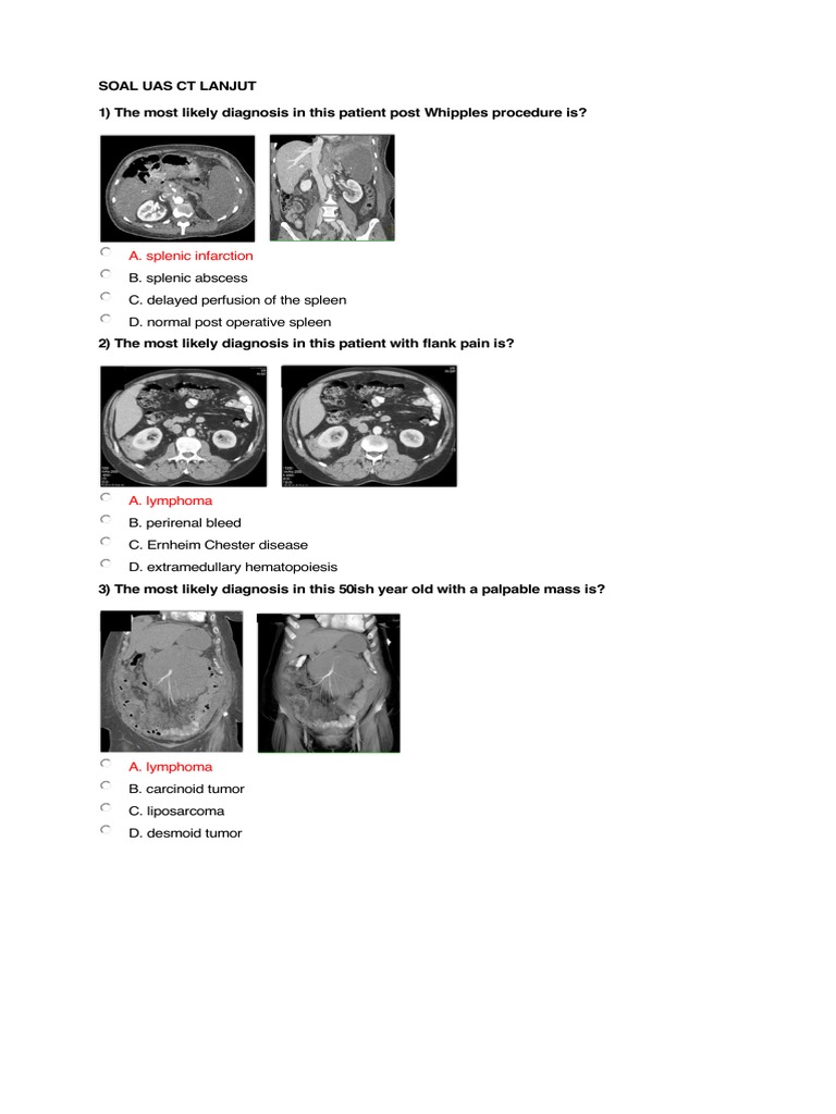 SOAL UAS CT LANJUT Mei 2021 | PDF | Neoplasms | Causes Of Death