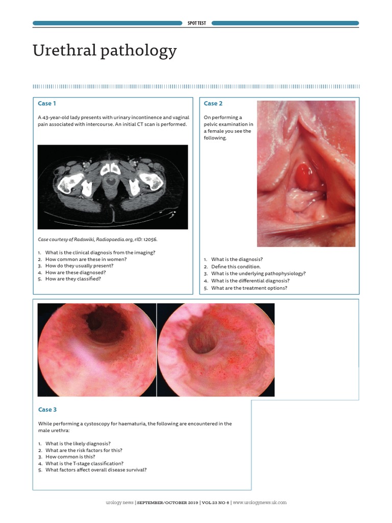 Urethral Pathology: Case 1 Case 2 | PDF | Urinary Incontinence ...