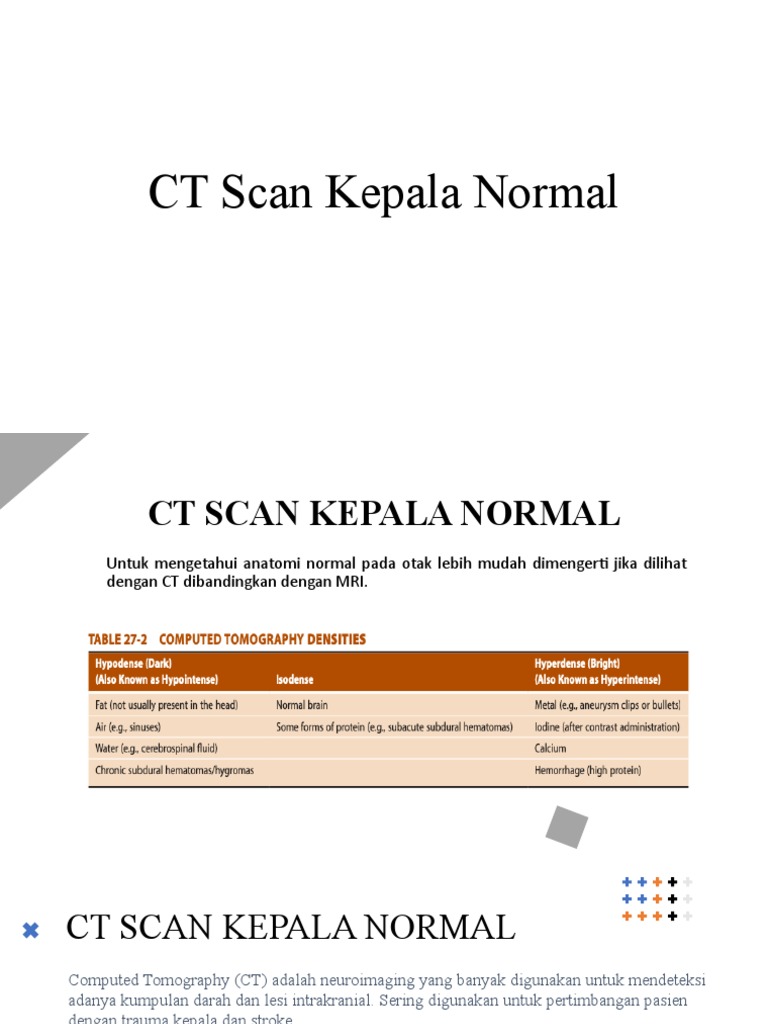 CT Scan Kepala Normal Kelompok 18 | PDF