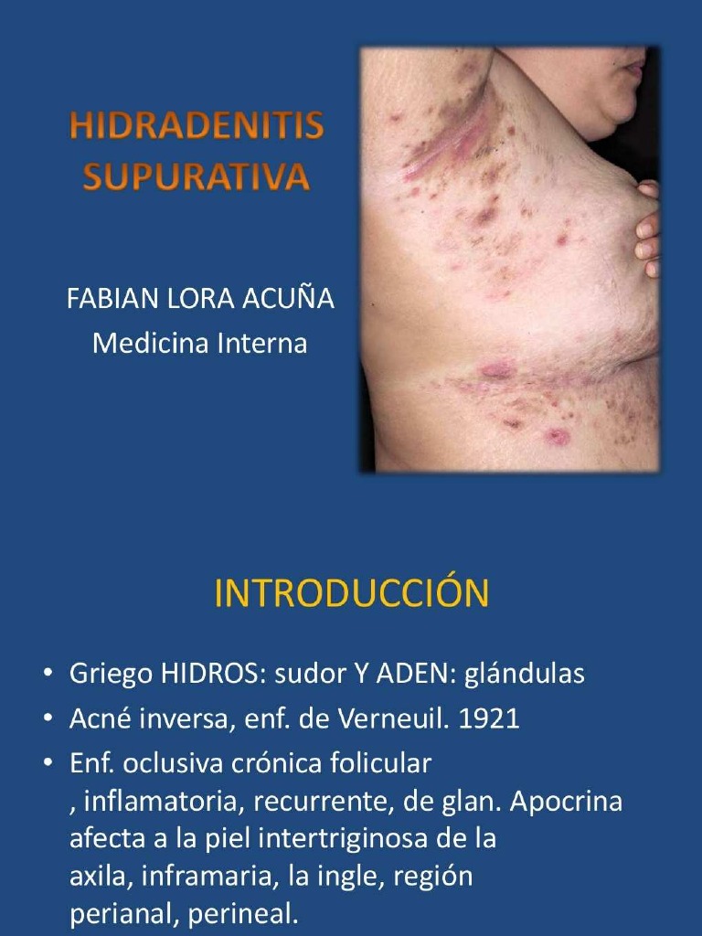 PDF Hidradenitis Supurativa - Compress | PDF