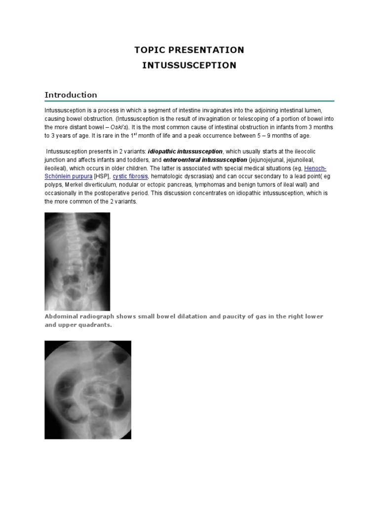 Presentation - Intussusception | PDF | Gastroenterology | Medical ...