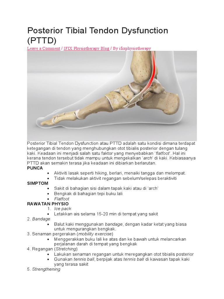 Posterior Tibial Tendon Dysfunction | PDF