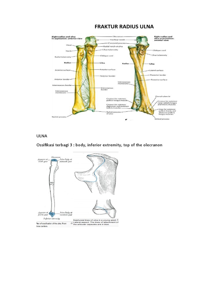Fraktur Radius Ulna | PDF