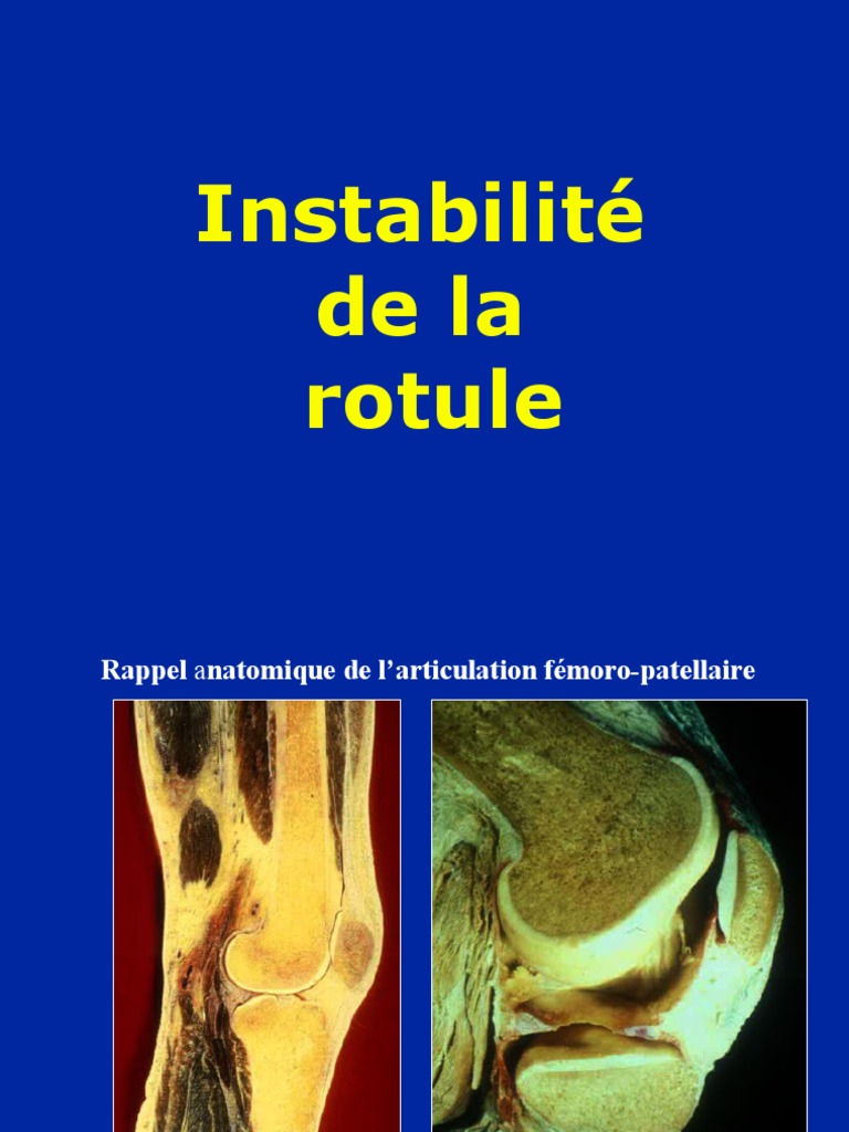 08 - Rotule Luxations - Iatrogenese - Rotules Basses | PDF | Genou ...