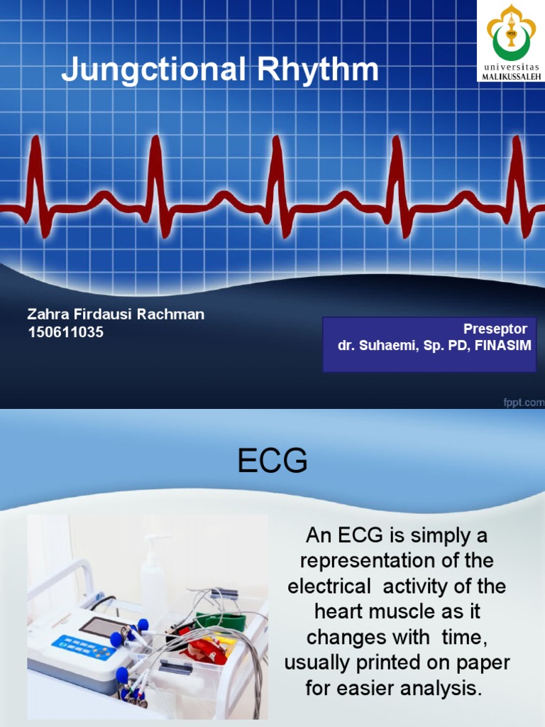 Junctional Rhtym | PDF