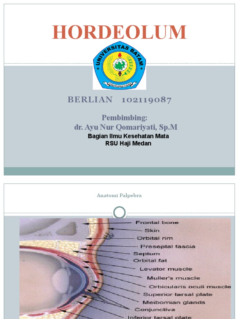 Hordeolum PPT Berin | PDF