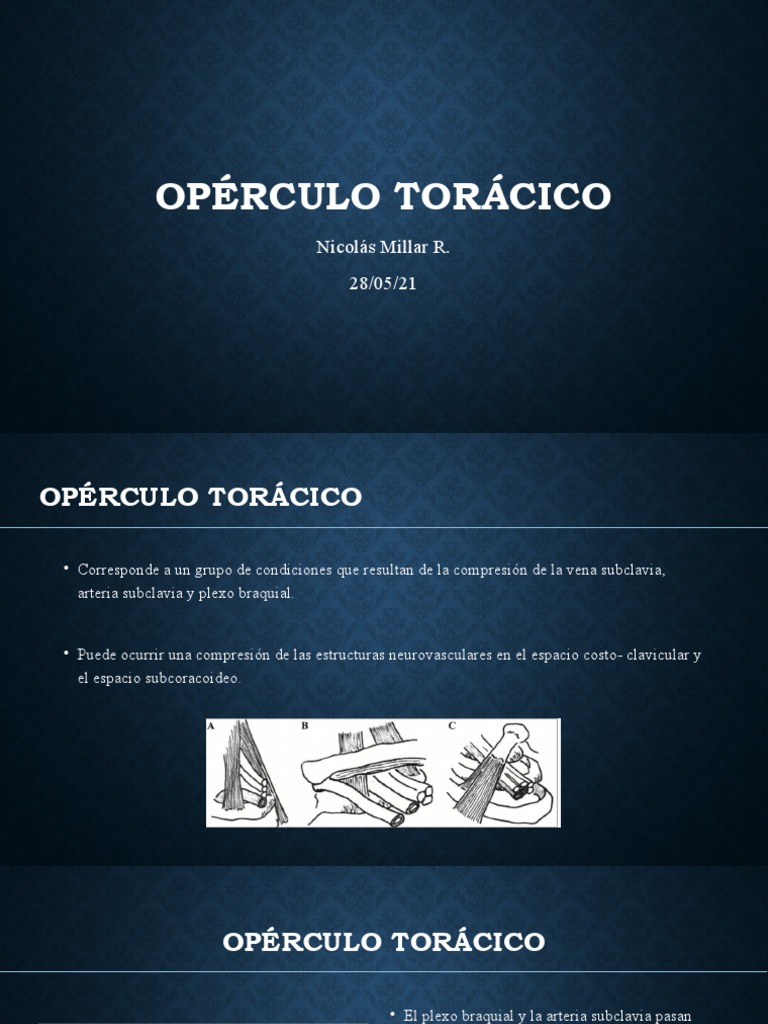 Síndrome de Opérculo Torácico: Causas y Tratamiento | PDF | Sistema ...
