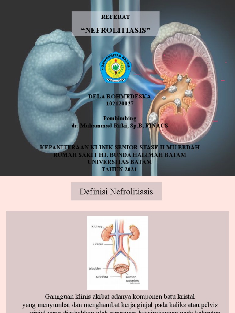 NEFROLITIASIS | PDF