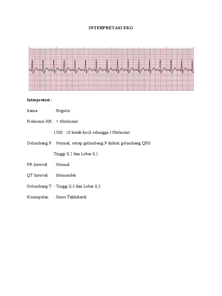 Interpretasi Ekg | PDF