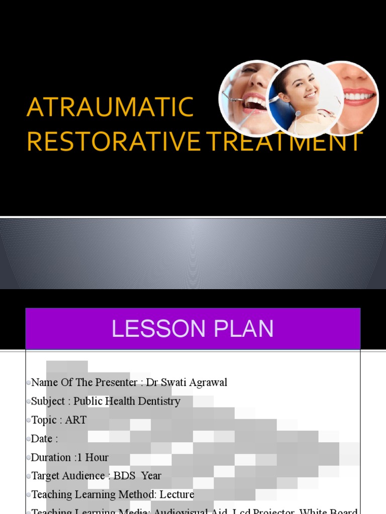 A Comprehensive Guide to Atraumatic Restorative Treatment (ART) | PDF ...
