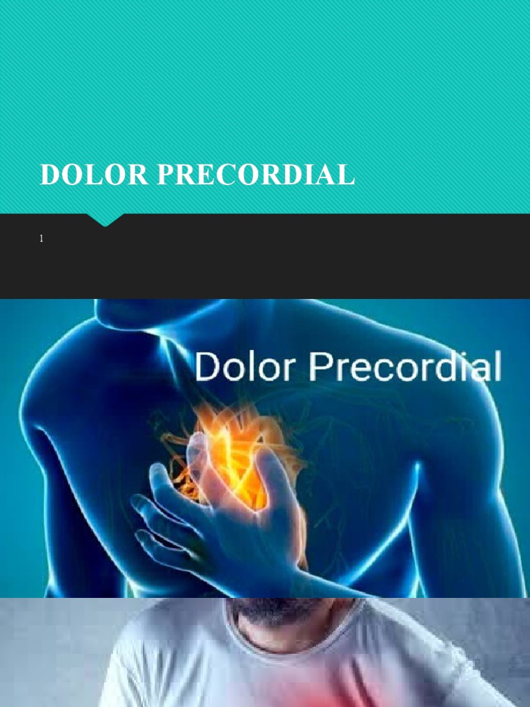 Dolor Precordial | PDF