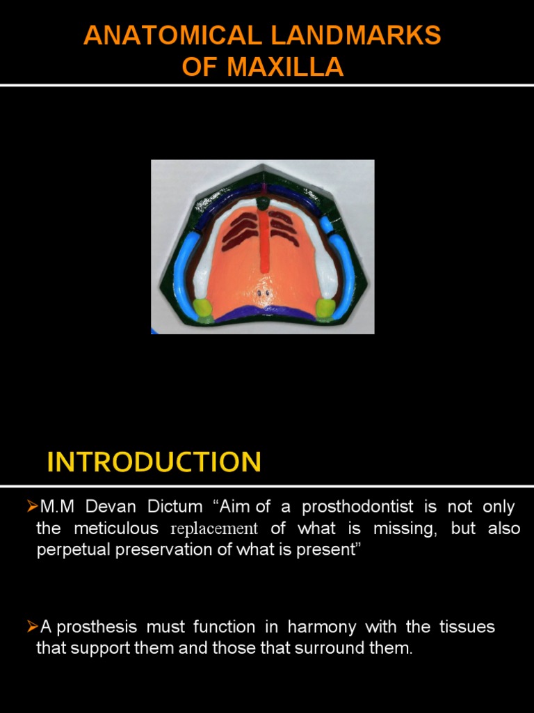 Hamular Notch Anatomy