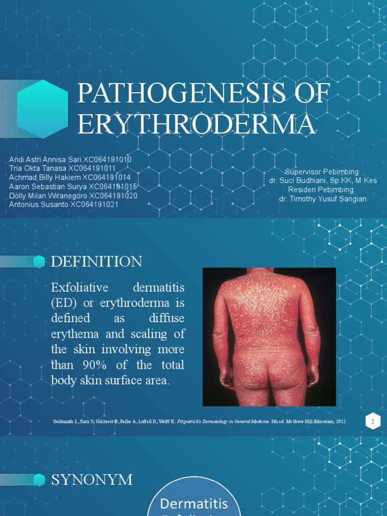 Group 5 - Pathogenesis of Erythroderma | PDF | Psoriasis | Dermatology
