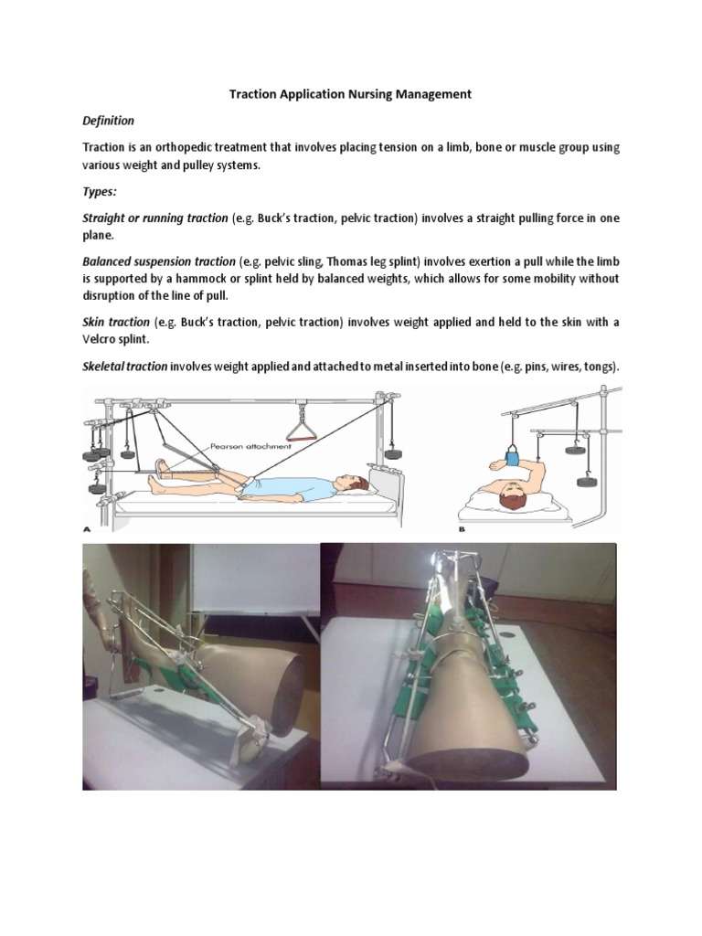 TRACTION SKIN and Skeletal Application Nursing Management | PDF ...