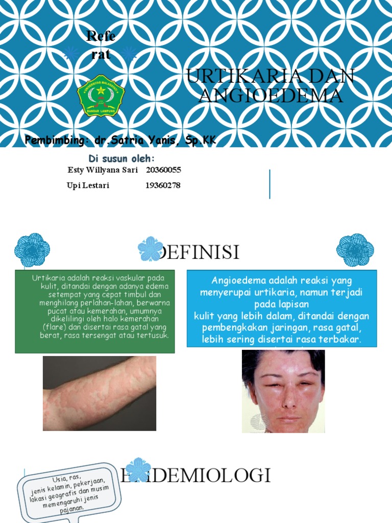 Urtikaria dan Angioedema: Panduan Lengkap | PDF