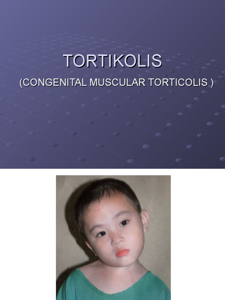 TORTIKOLIS | PDF | Pengembangan Diri | Kesehatan Holistik