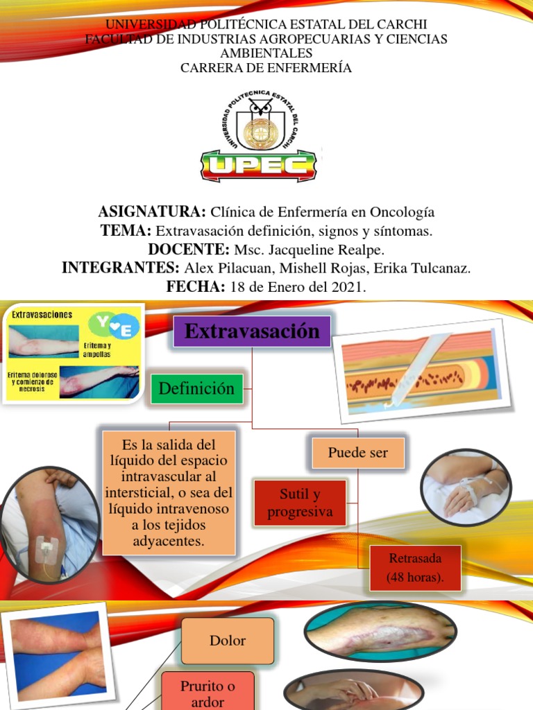 Extravasación Definición. | PDF