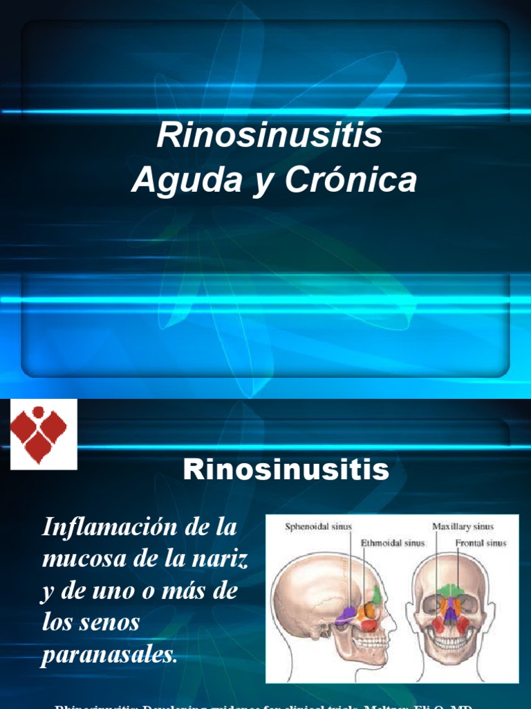 Sinusitis Aguda y Cronica | PDF | Epidemiología | Microbiología