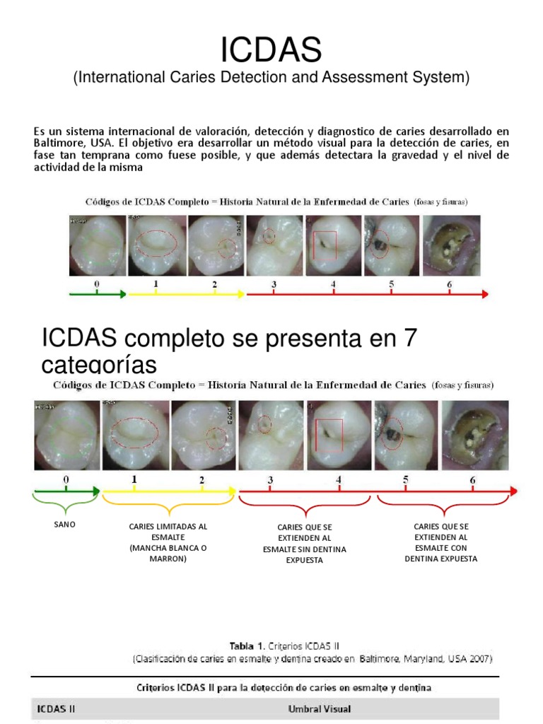 ICDAS | PDF | Esmalte de dientes | Diente