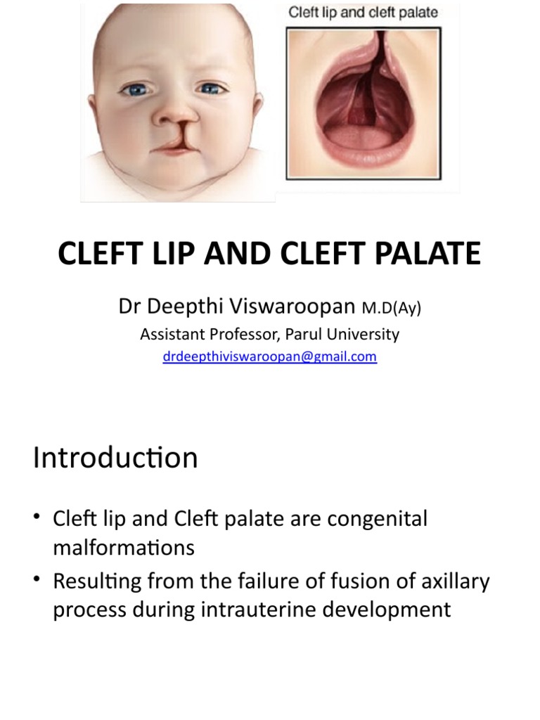 Cleft Lip and Cleft Palate | PDF | Human Nose | Human Head And Neck