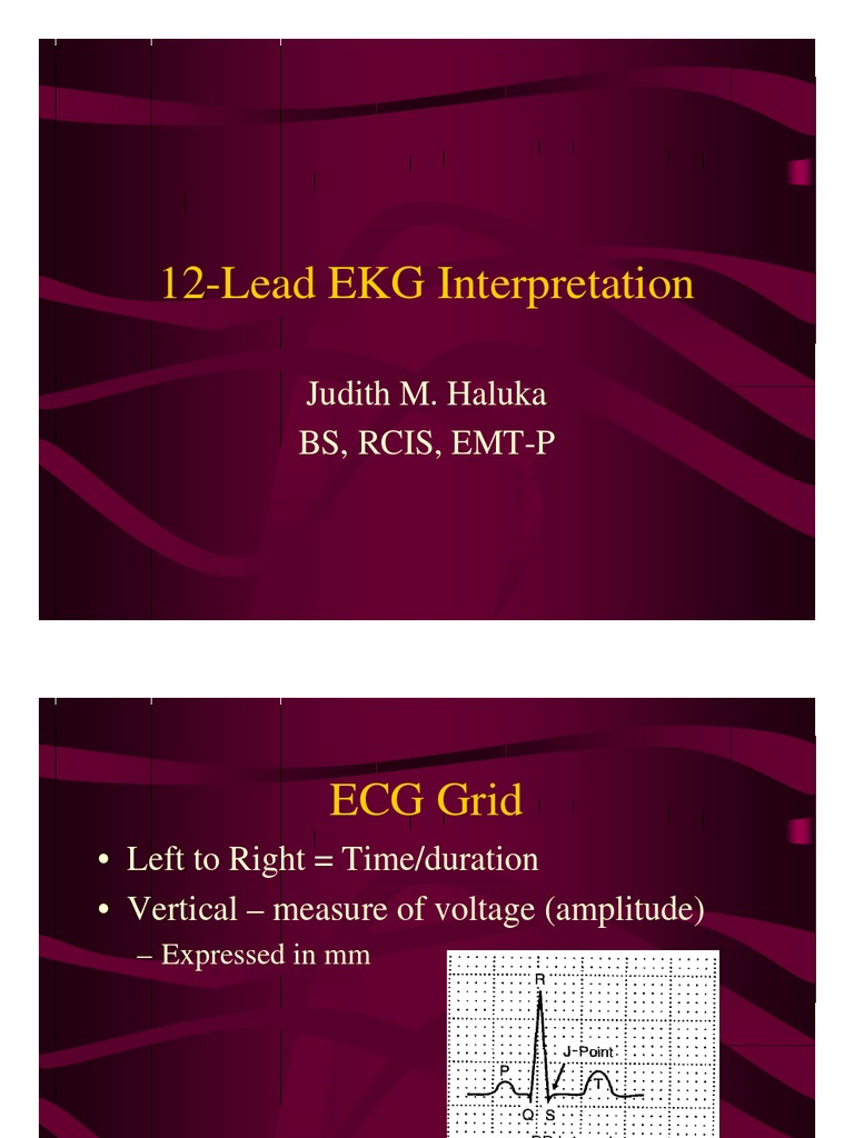 12-Lead EKG Interpretation | PDF